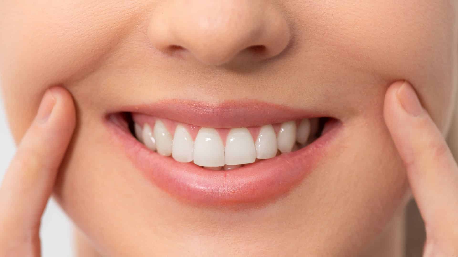 How to Care for Your Teeth After Whitening Treatment