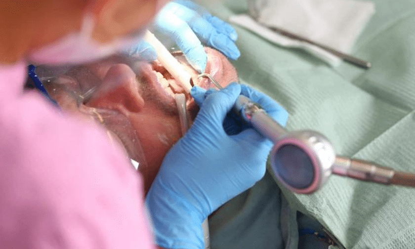 What Tools are Used for Gum Contouring? | Gila Ridge Dental